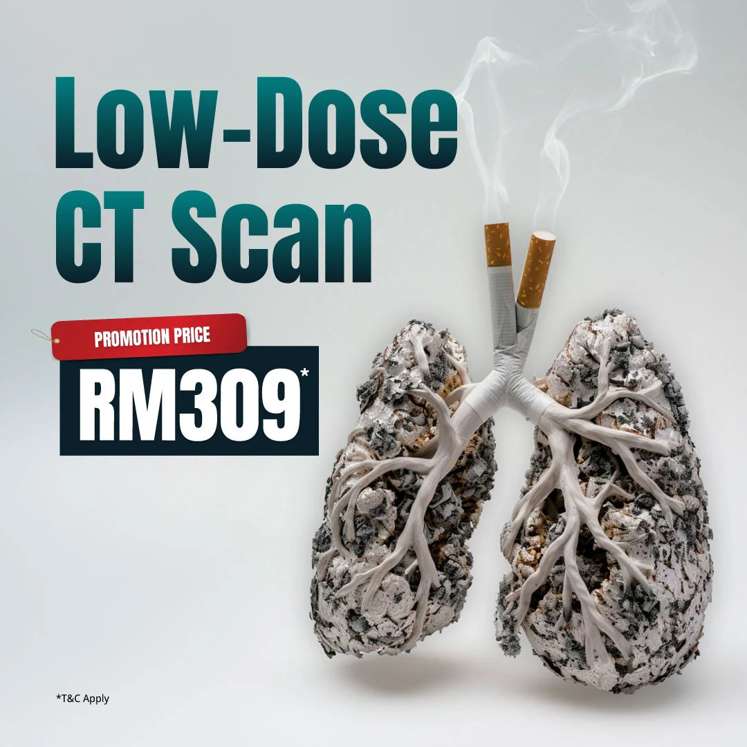 LDCT Promotion – Beacon Health Screening Centre