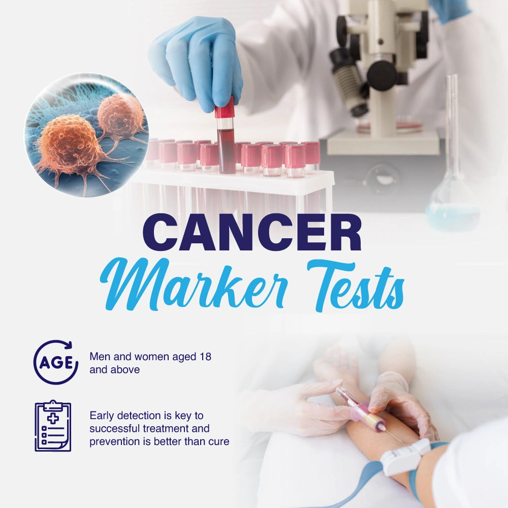 Cancer Marker Tests | Detect Early Signs of Cancer – Beacon Health ...