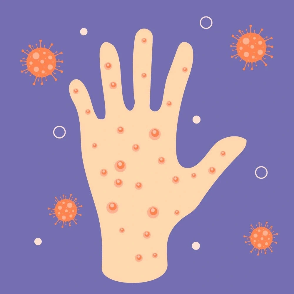 Rubella IgG Test | Accurate Immunity Screening for Rubella Virus ...